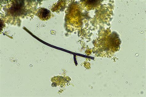 รูปภาพarthroconidia เลือกดูภาพถ่ายสต็อก เวกเตอร์ และวิดีโอ108 Adobe