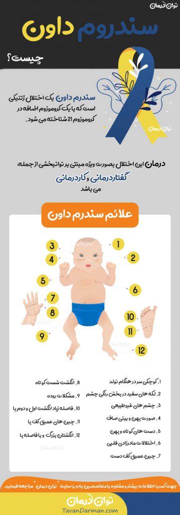 جامع ترین مرجع سندرم داون ارزیابی، تشخیص، علایم و درمان توان درمان