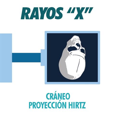 RX Craneo Proyeccion Hirtz Laboratorio Médico Samalab