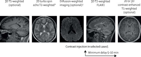 2021 Magnimscmscnaims Consensus Recommendations On The Use Of Mri In
