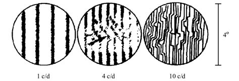 Spatial Distortions Of Amblyopic Vision Gratings Of Various Spatial Download Scientific