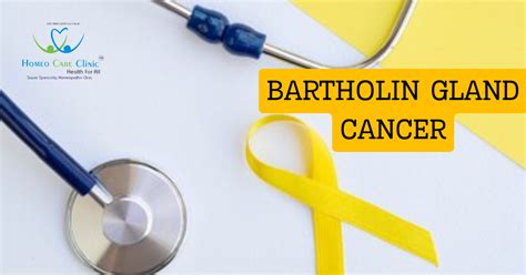 Bartholin Gland Cancer And Its Causes Symptoms And Homeopathy Remedies