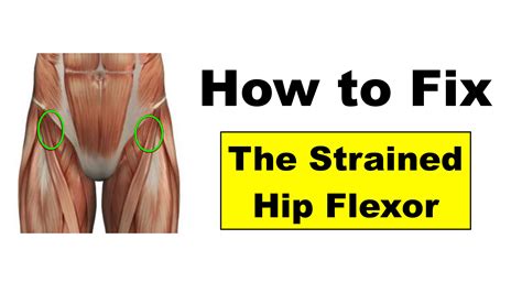 Hip Flexor Tendinopathy