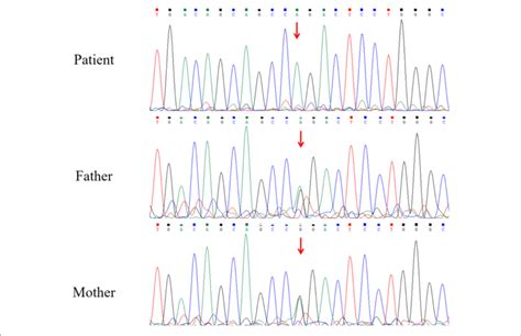 Results Of Sanger Sequencing Download Scientific Diagram