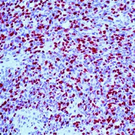Myogenin Monoclonal Antibody F5d Invitrogen™ 500 μl Unconjugated