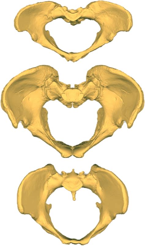 Australopithecus Sediba Pelvis