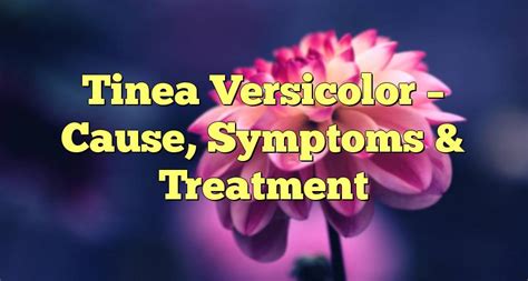 Tinea Versicolor Cause Symptoms And Treatment Smacr
