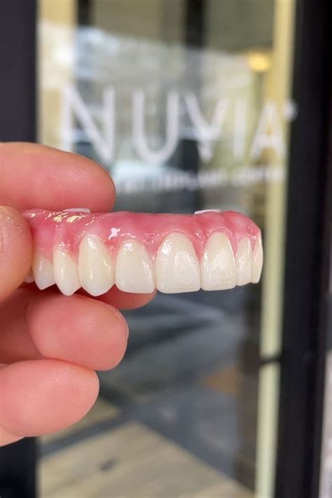 New Permanent Teeth In Just 24Hrs Dental Implants Teeth In A Day Dental