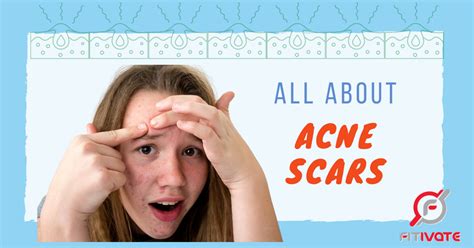 Types Of Acne Scars And Treatment Fitivate