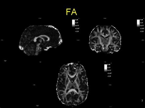 Introduction To Diffusion Mri Processing The Diffusion Process