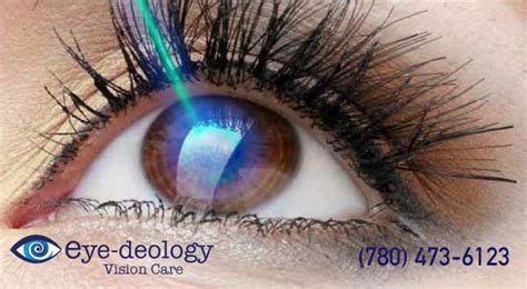 Myopia Management And Control Eye Deology Vision Care Edmonton