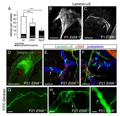 Integrin Alpha9 Is Required For Fibronectin Matrix Assembly During Lymphatic Valve Morphogenesis