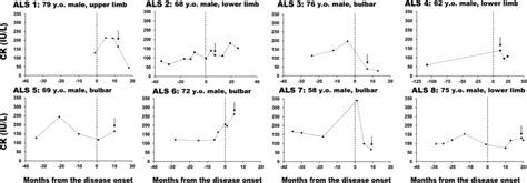 Retrospective Data Of Serum Ck Levels In 8 Subjects With Als Serum Ck
