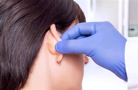 Ear Deformities Types Causes And Treatment