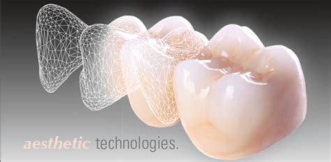 Dental Direkt口腔修复材料 行业 Ceramagix