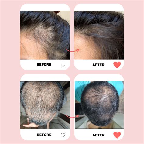 Ivachi The Premium Skin And Hair Care Products