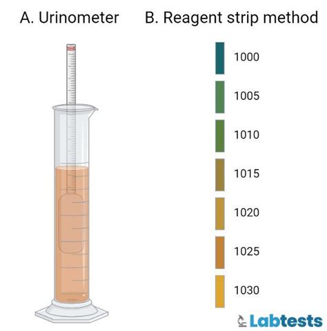 Urinalysis Specific Gravity Abnormal At Terry Swenson Blog