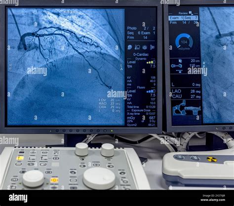 istanbul turkey 28 february 2024 angiogram sequence working clockwise