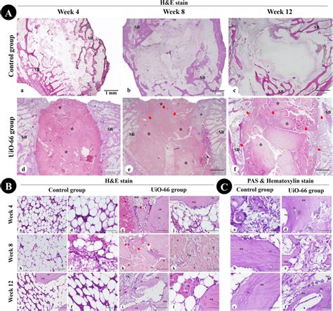 Histological Assessment Of Critical Sized Bone Defect Repair In Rabbit