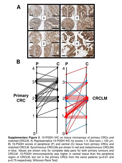 PPT Primary CRC PowerPoint Presentation Free Download ID