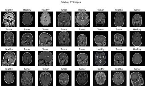 Neuromedic Deep Learning Based Mri Classification For Brain Tumor