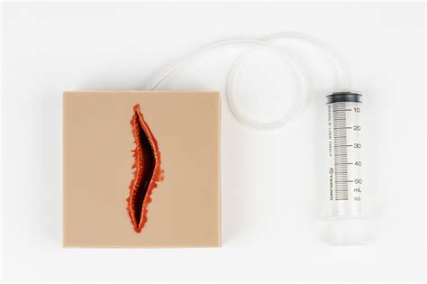 Haemostatic Dressing Application At Tyrone Ver Blog