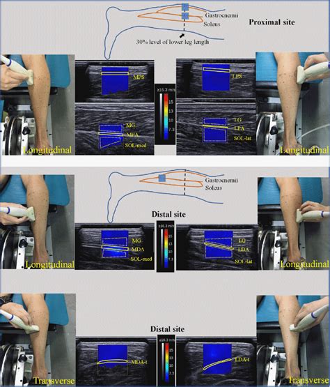 Locations Of Shear Wave Elastography Transducer And Typical Maps Of Download Scientific Diagram