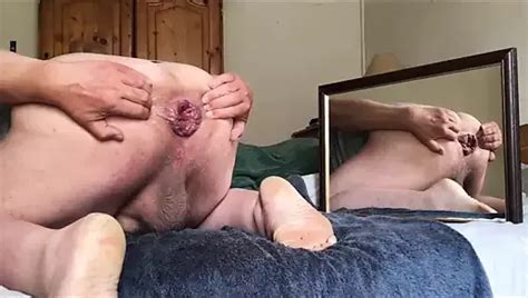 Haute Définition Béance Anale Avec Une Grosse Orange Xhamster