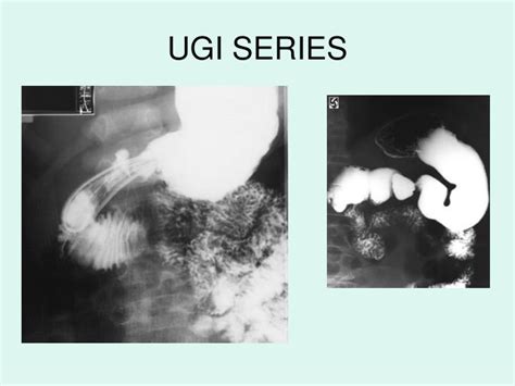 Ppt The Aging Gi System Powerpoint Presentation Id6057545