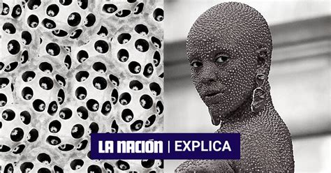 Tripofobia Causas