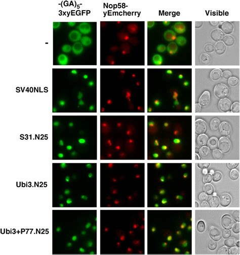 The N Terminal Tail Of S31 Contains A Functional Nls Sequence Strain