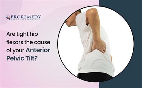 Are Tight Hip Flexors The Cause Of Your Anterior Pelvic Tilt