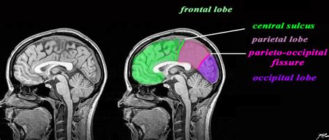 Central Sulcus The Common Vein