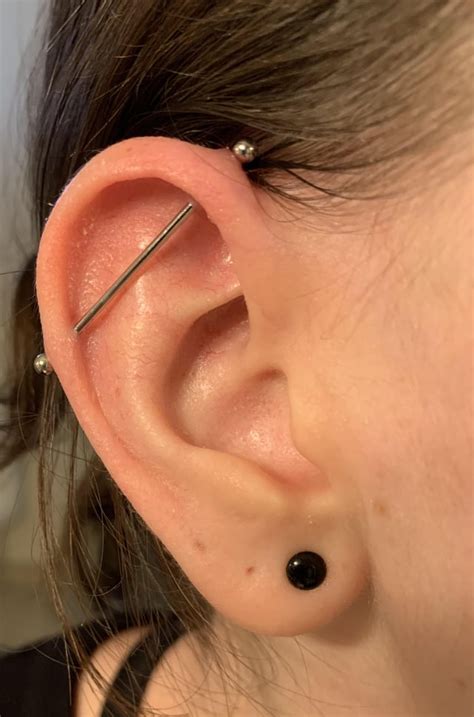 My Industrial Piercing Is Developing A Bump Please See Details In