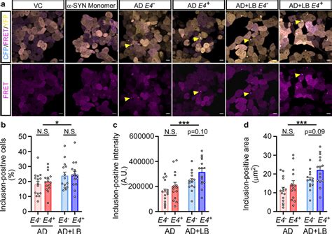 The seeding activity of α SYN aggregates derived from human AD brain