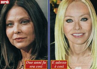 Chatter Busy Ornella Muti Plastic Surgery Celebrity Plastic Surgery