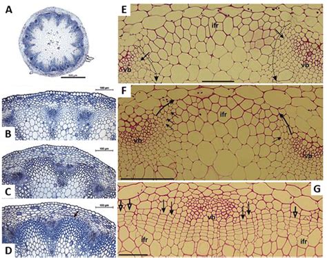 The Progression Of Secondary Development In The Arabidopsis