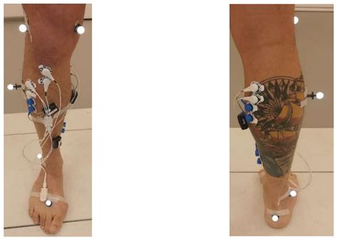 flexible machine learning algorithms for clinical gait assessment tools