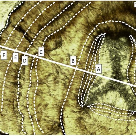 Growth Rings In The Cross Section Of The Corallium Japonicum Axis