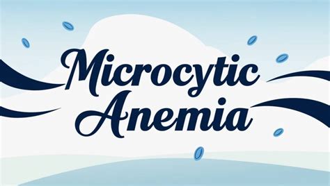 Sideroblastic Anemia Causes Symptoms And Treatments