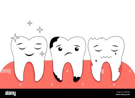 Clean Dirty Teeth Line Concept Stock Vector Image Art Alamy