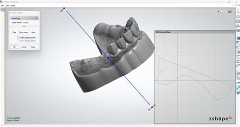 Digital Rpd Model 3d Model 3d Printable Cgtrader
