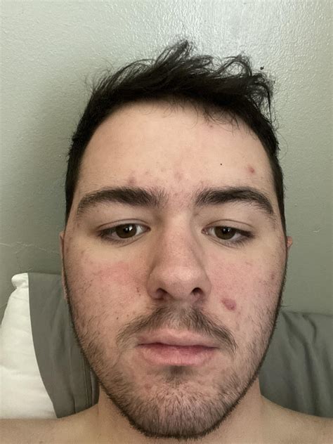 18m Working On The Mustache Stubble Combo Been Doing The Full Beard