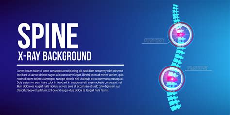 배경에서 척추 X 선 통증 목 디스크 성능 저하 부상 치료의 창조적 인 벡터 일러스트 예술 디자인 의료 배너 템플릿입니다