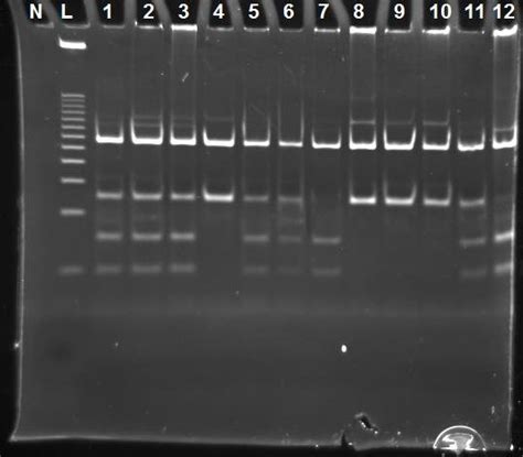 Genotyping Of Rs653178 By The Designed Pcr Rflp Method Lanes N