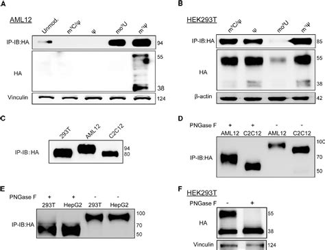 Figure 1 From Chemically Modified In Vitro Transcribed Mrna Encoding
