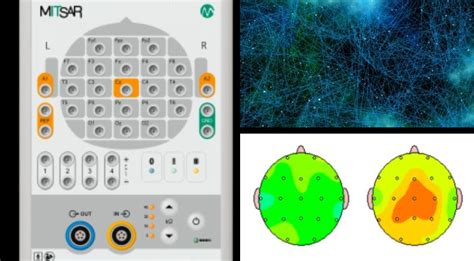 Successful Practitioner On Linkedin Qeeg Neuroguide Wineeg Healthcareproviders Brainmapping…