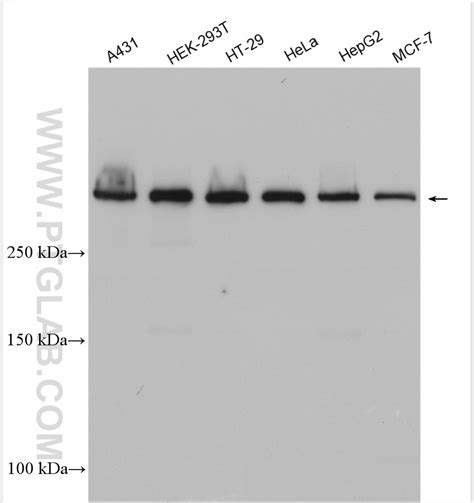 Rif1 Antibody 30119 1 Ap Proteintech