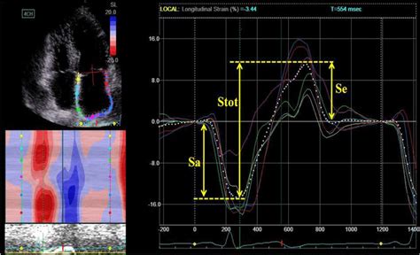 Left Atrial Phasic Strain Measurements From Four Chamber Apical View By Download Scientific