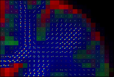 Section Of An In Vivo Human Brain Coronal Slice At 25 Mm Isotropic